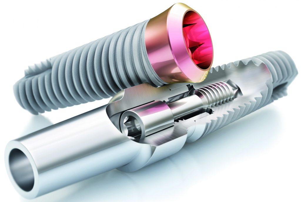 TRI® Dental Implants introduces digital library for creating individual ...